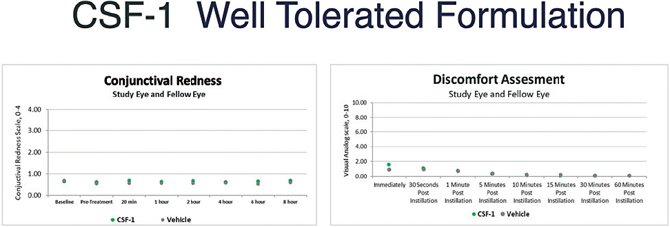 Presbyopia Physician | PentaVision