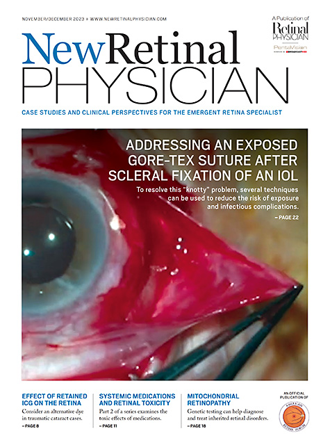 Presbyopia Physician | PentaVision